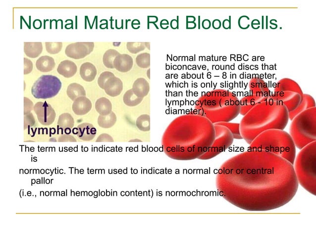 RBC morphology and Disease that may be associated with abnormal ...