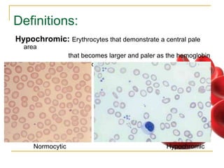 RBC morphology and Disease that may be associated with abnormal ...