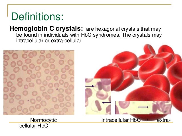 RBC morphology and Disease that may be associated with abnormal morph…