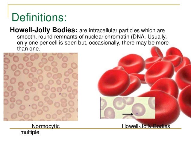 RBC morphology and Disease that may be associated with abnormal morph…
