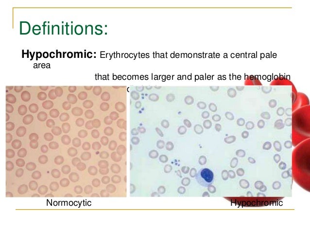 Types Of Rbc Morphology