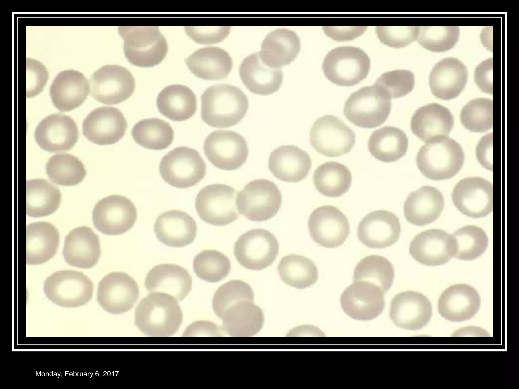 Rbc morphology | PPT