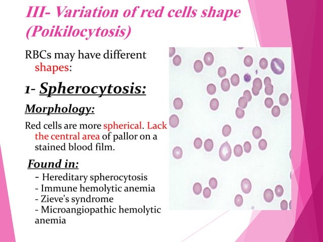 RBC Morphology.pdf