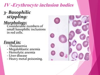 RBC Morphology.pdf