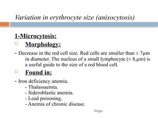 RBCs-Abnormal-morphology-final. Cytomophologypptx | PPTX