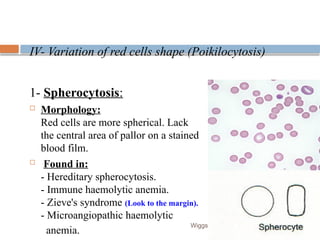 RBCs-Abnormal-morphology-final. Cytomophologypptx | PPT
