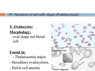 RBCs-Abnormal-morphology-final. Cytomophologypptx | PPT