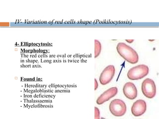 RBCs-Abnormal-morphology-final. Cytomophologypptx | PPT
