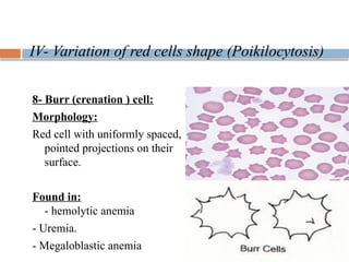 RBCs-Abnormal-morphology-final. Cytomophologypptx | PPT
