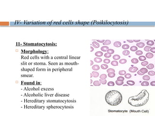 RBCs-Abnormal-morphology-final. Cytomophologypptx | PPT