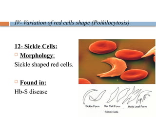RBCs-Abnormal-morphology-final. Cytomophologypptx | PPTX