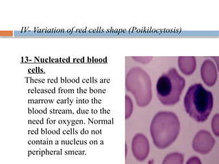 RBCs-Abnormal-morphology-final. Cytomophologypptx | PPTX