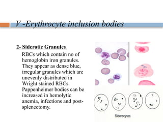 RBCs-Abnormal-morphology-final. Cytomophologypptx | PPTX