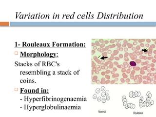RBCs-Abnormal-morphology-final. Cytomophologypptx | PPT