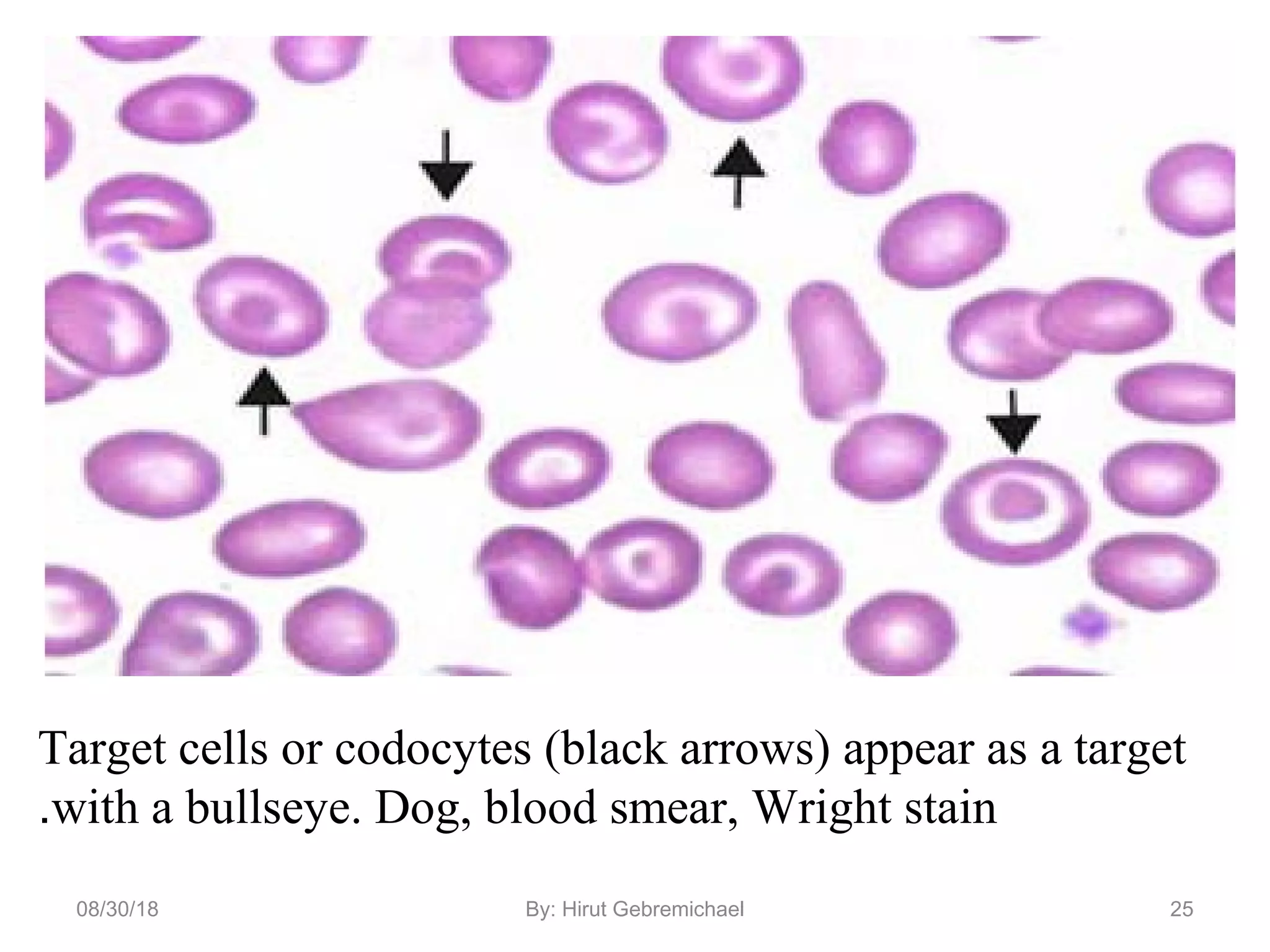 Red Blood Cell disorder | PPT