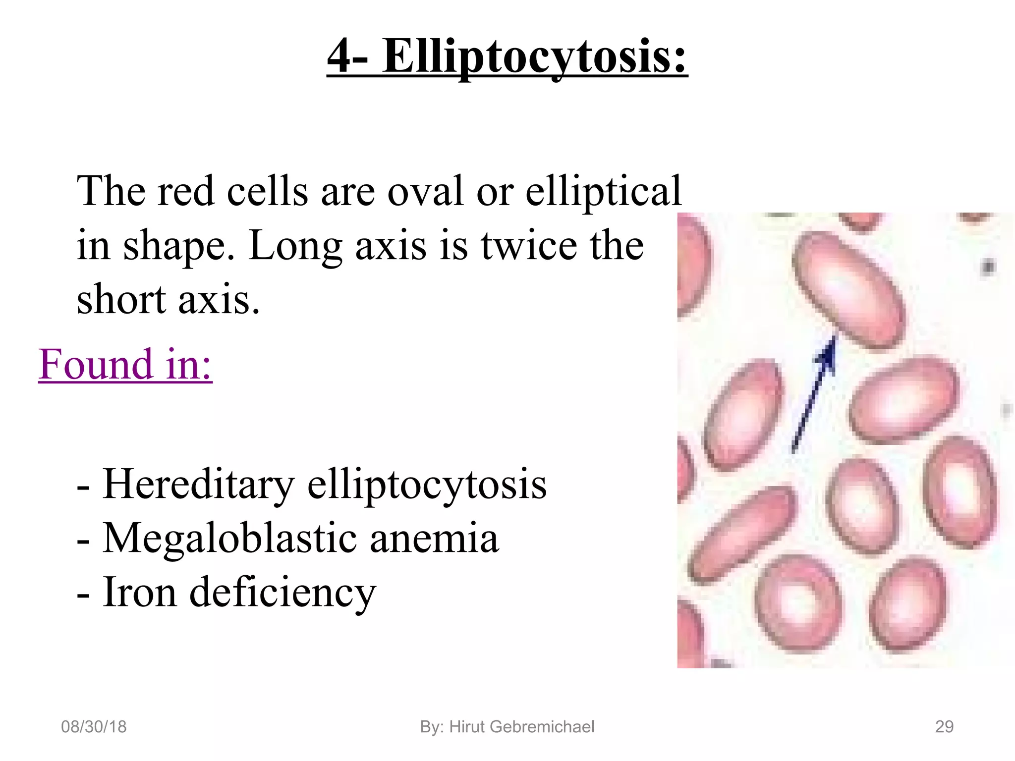 Red Blood Cell disorder | PPT