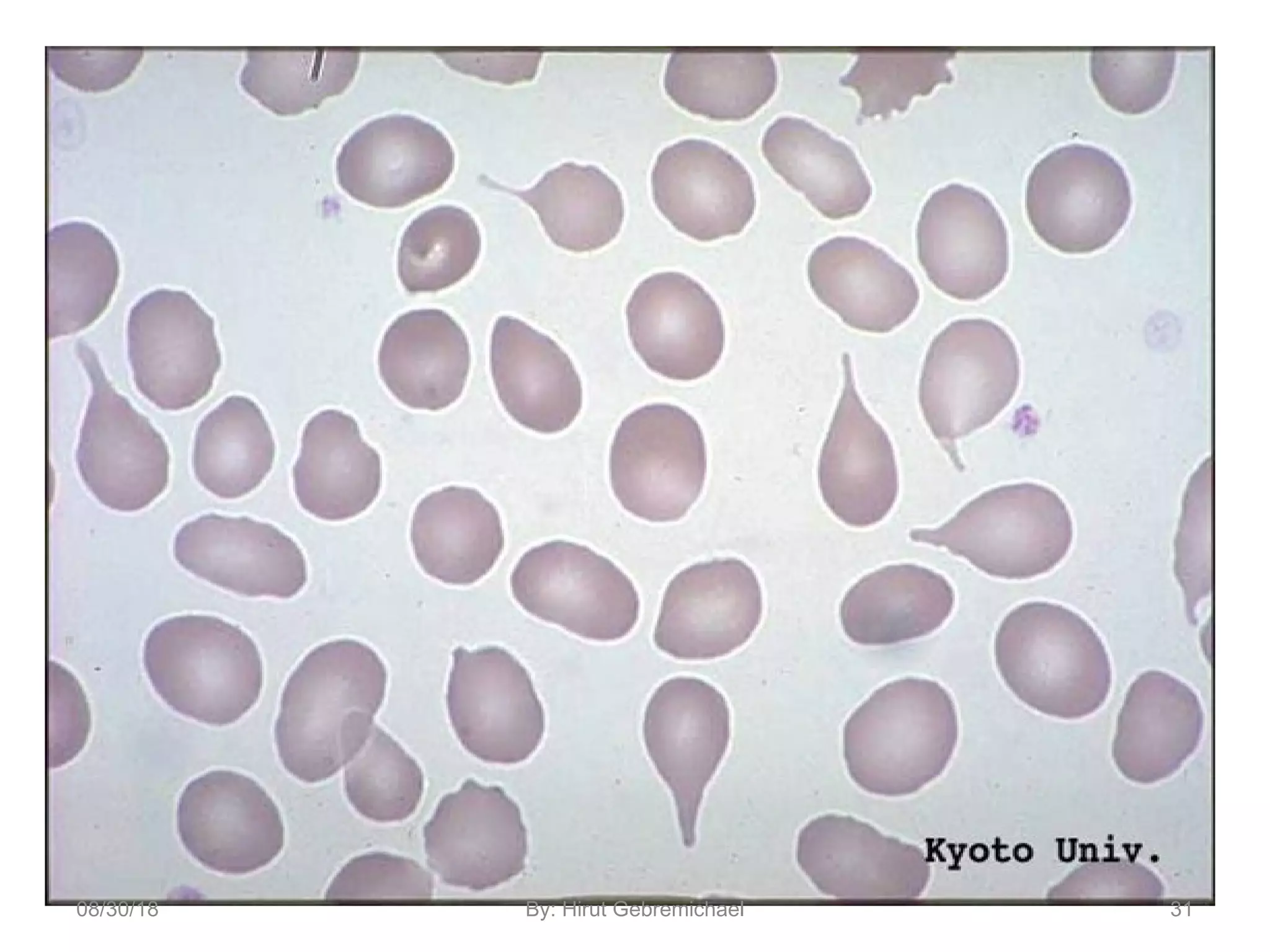 Red Blood Cell disorder | PPT