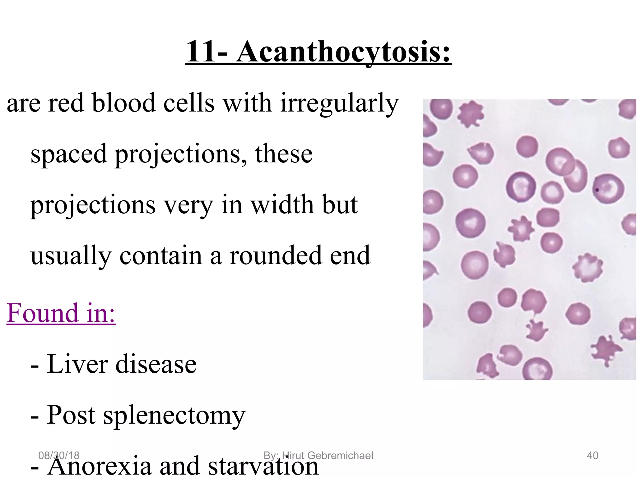 Red Blood Cell disorder | PPT