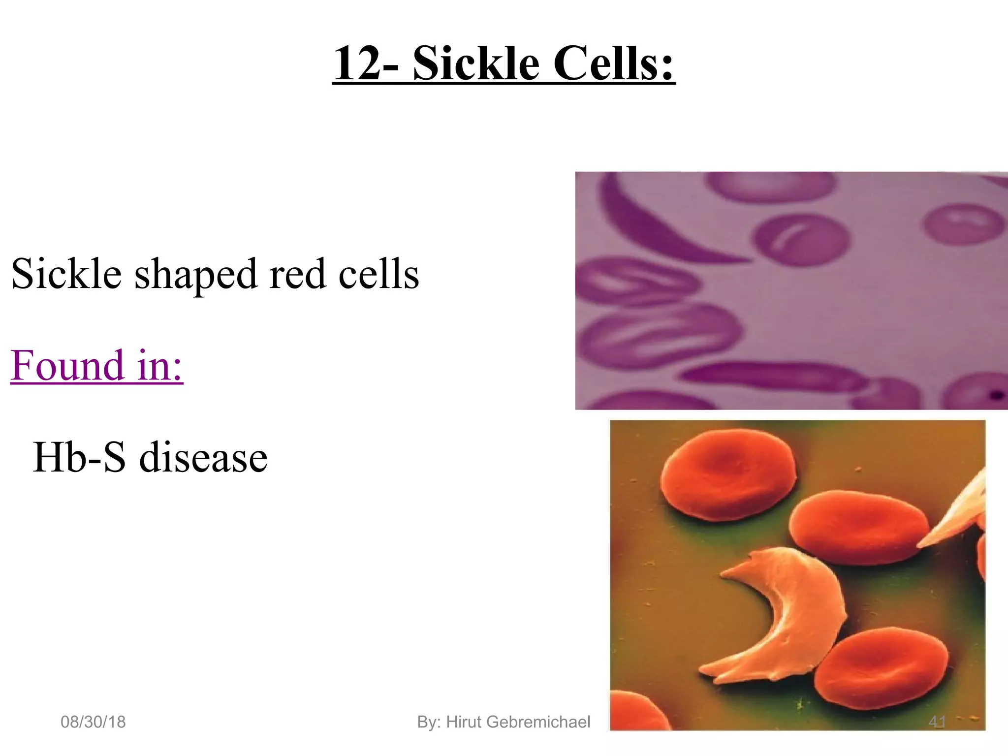 Red Blood Cell disorder | PPT
