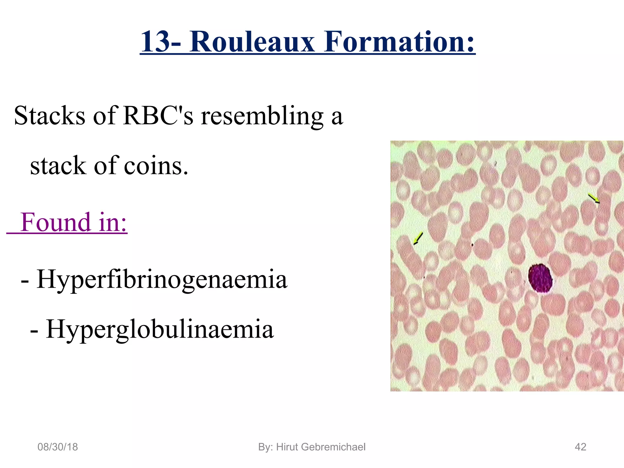 Red Blood Cell disorder | PPT