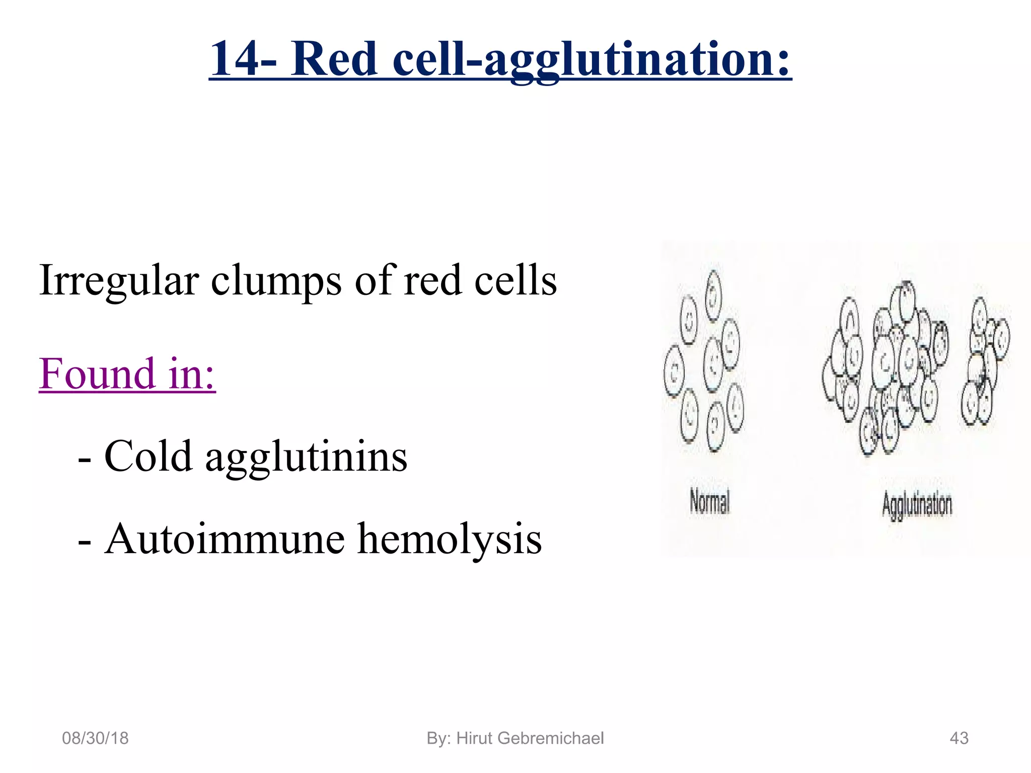 Red Blood Cell disorder | PPT
