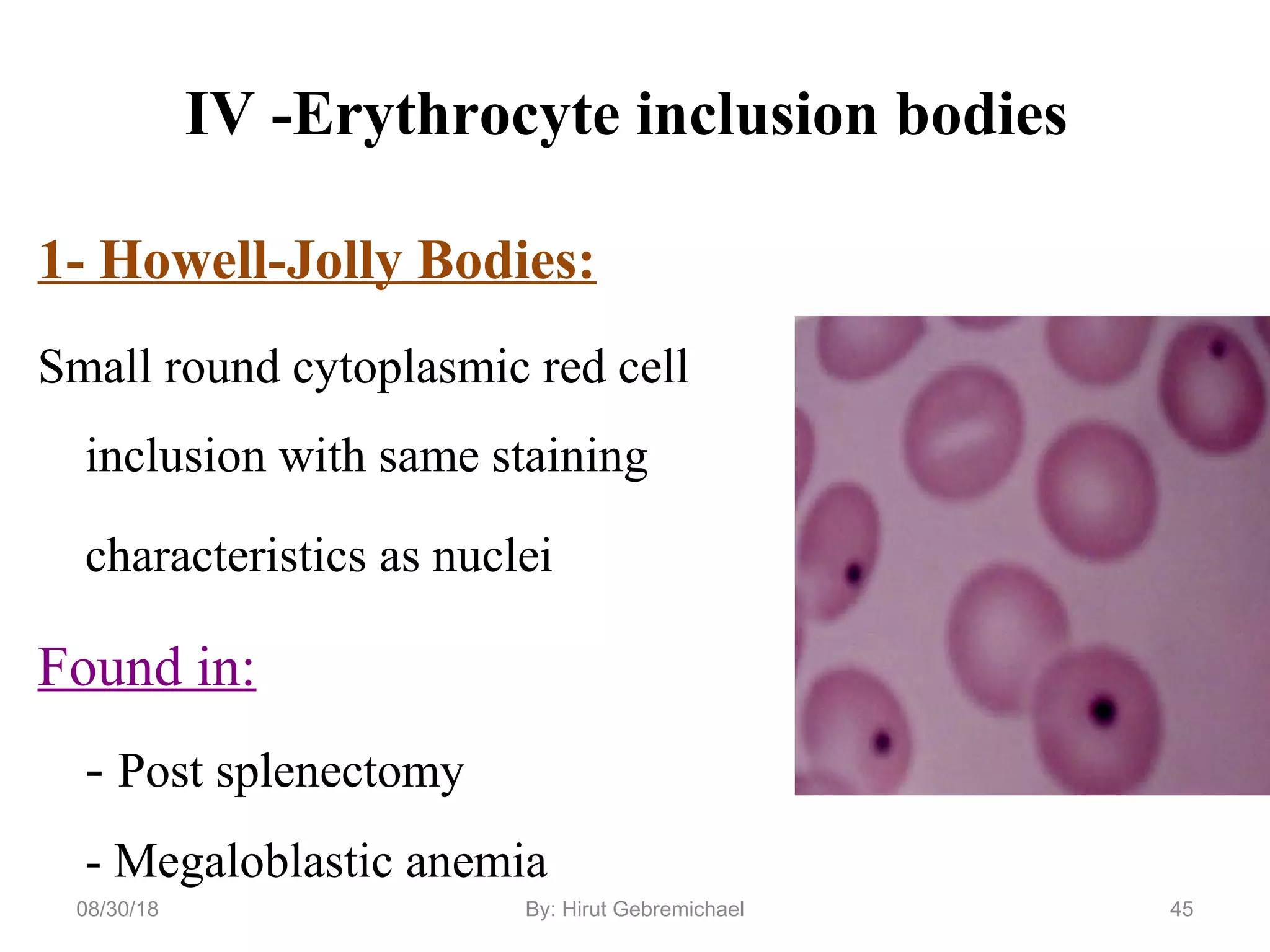 Red Blood Cell disorder | PPT
