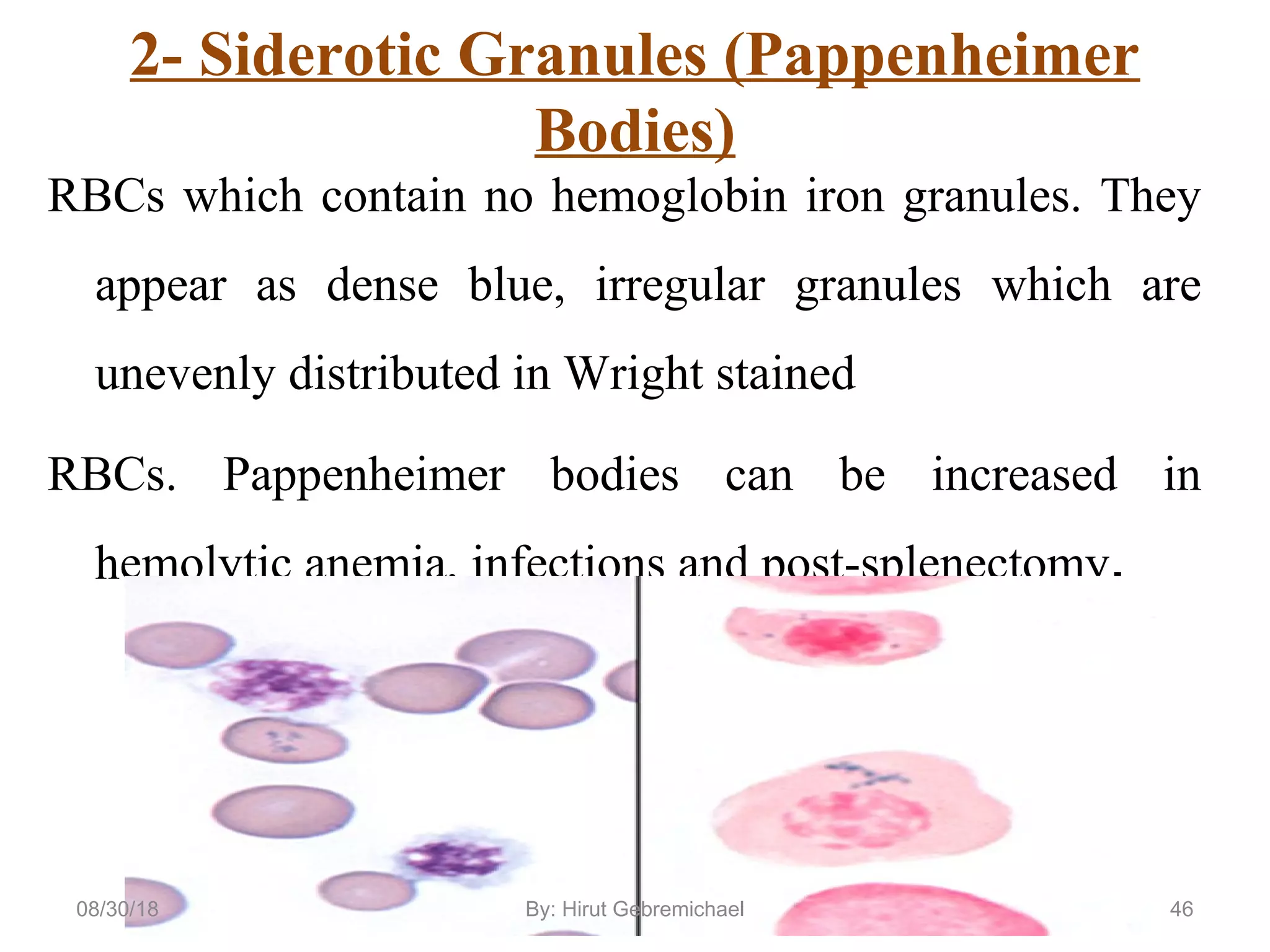 Red Blood Cell disorder | PPT