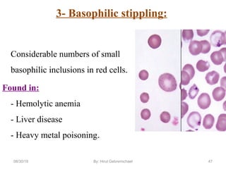 Red Blood Cell disorder | PPT