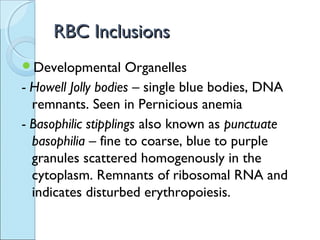 RBC Variation | PPT