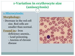 RBC & WBC abnormalities and their interpretation | PPTX