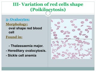 RBC & WBC abnormalities and their interpretation | PPTX