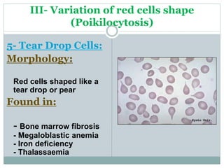 RBC & WBC abnormalities and their interpretation | PPTX