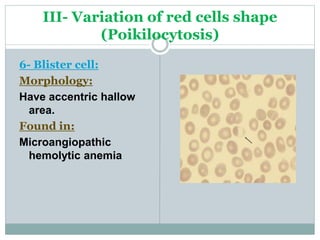 RBC & WBC abnormalities and their interpretation | PPTX