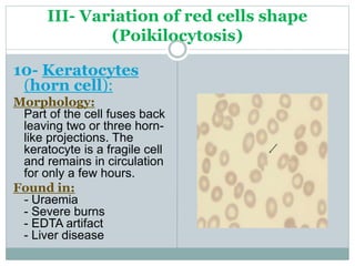 RBC & WBC abnormalities and their interpretation | PPTX