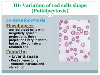 RBC & WBC abnormalities and their interpretation | PPTX
