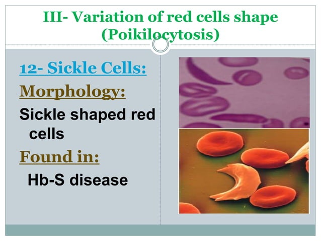 RBC & WBC abnormalities and their interpretation | PPTX | Blood ...