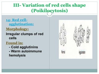 RBC & WBC abnormalities and their interpretation | PPTX