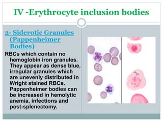 RBC & WBC abnormalities and their interpretation | PPTX