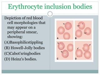 RBC & WBC abnormalities and their interpretation | PPTX