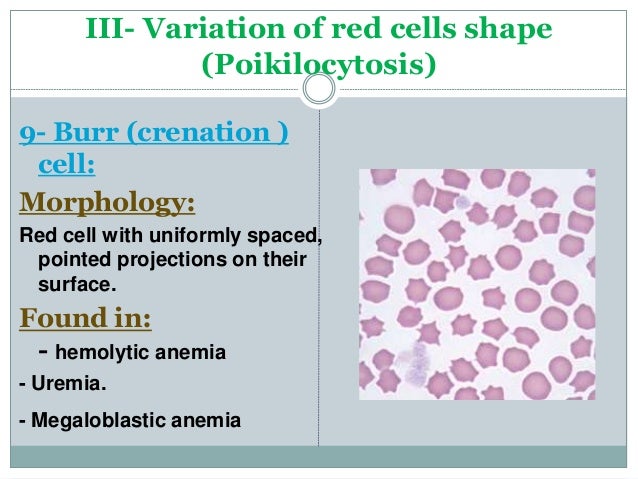RBC & WBC abnormalities and their interpretation