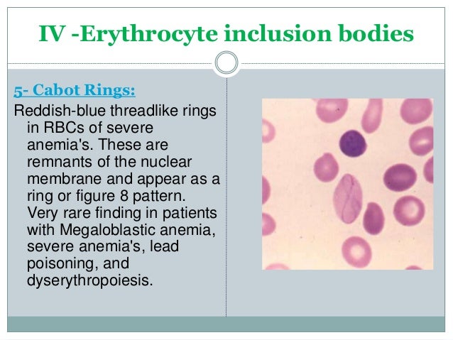 RBC & WBC abnormalities and their interpretation