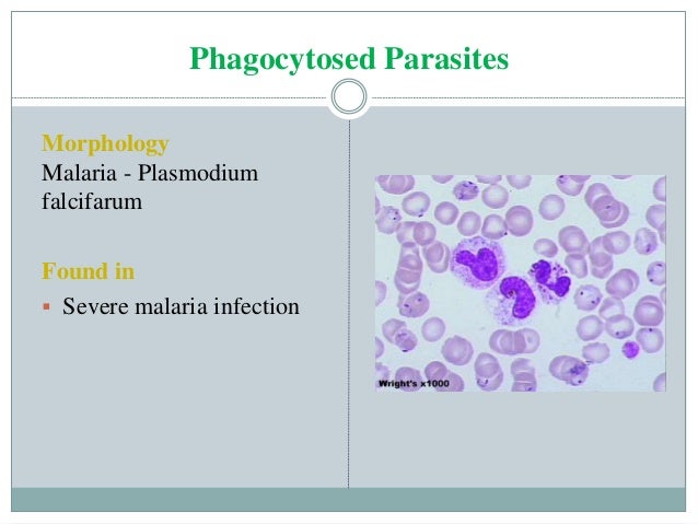 RBC & WBC abnormalities and their interpretation