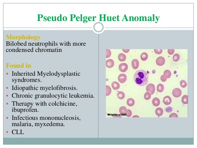 RBC & WBC abnormalities and their interpretation