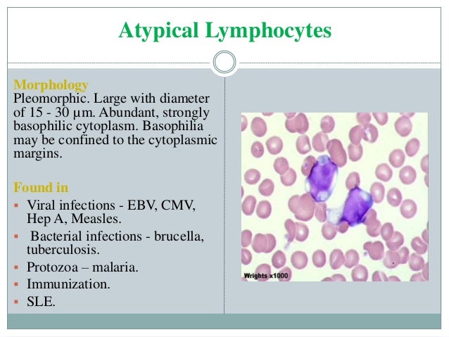 RBC & WBC abnormalities and their interpretation