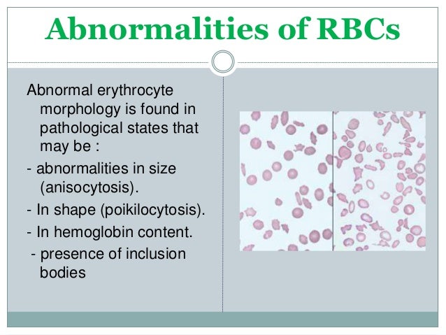 RBC & WBC abnormalities and their interpretation
