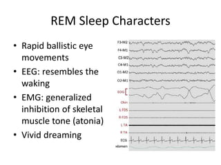 Rapid eye movement sleep behavior disorders | PPTX