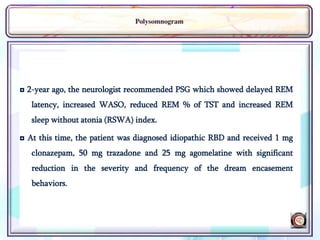 REM behaviour disorder and dementia with Lewy bodies | PPTX