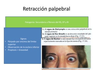orbita ocular | PPTX