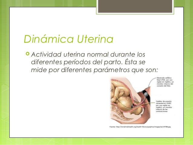 RBNS y DU