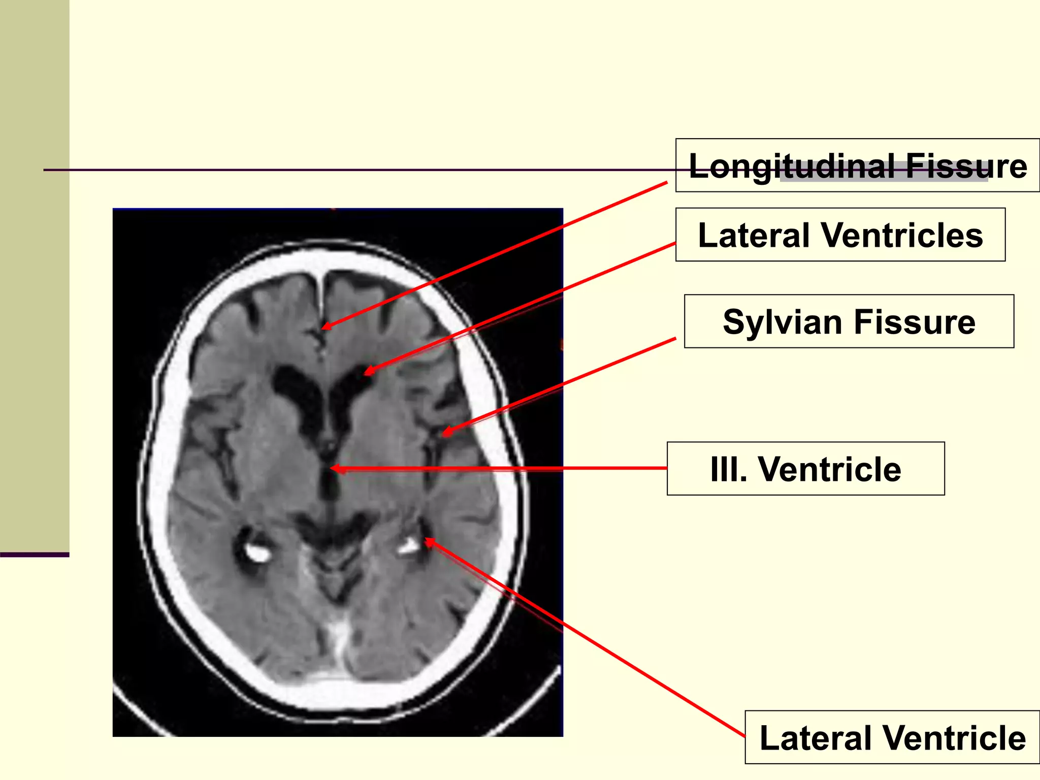 (R)brain ct anatomy (1) | PPT